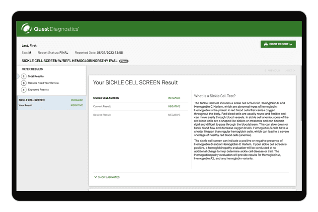 Sickle Cell Trait Screen Test with Reflex